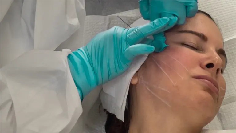 Treatments Plans | Perfect B