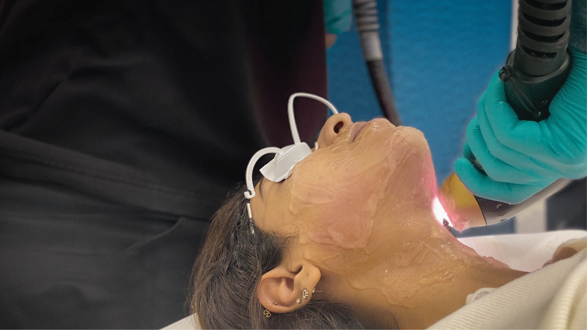 Laser Hair Removal Perfect B Laser Hair Removal Perfect B
