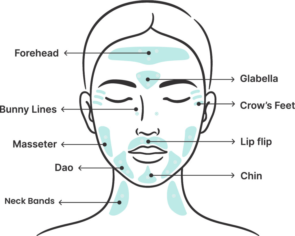 Neurotoxin Treatment | Perfect B
