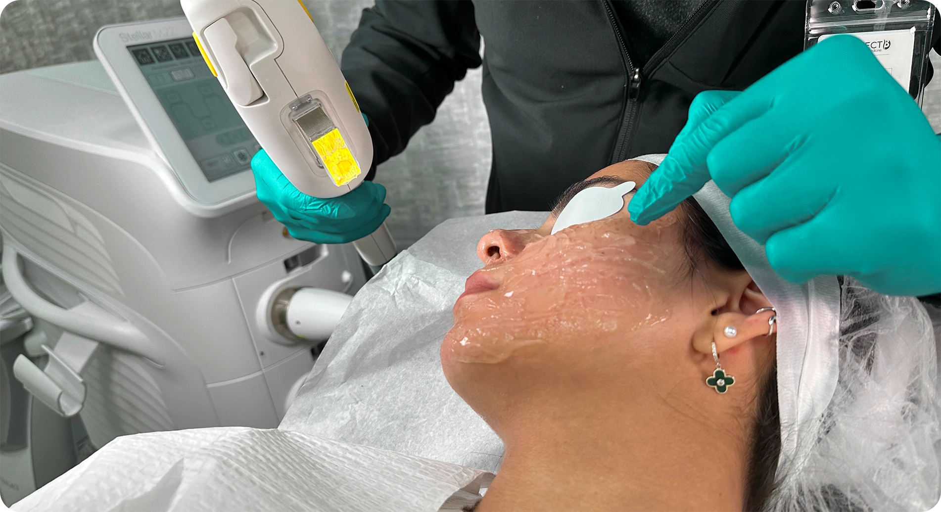 How does a Skin Brightening Treatment improve uneven tone? | Perfect B