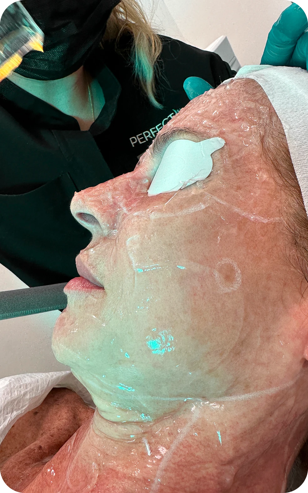 How does a Skin Brightening Treatment improve uneven tone? | Perfect B