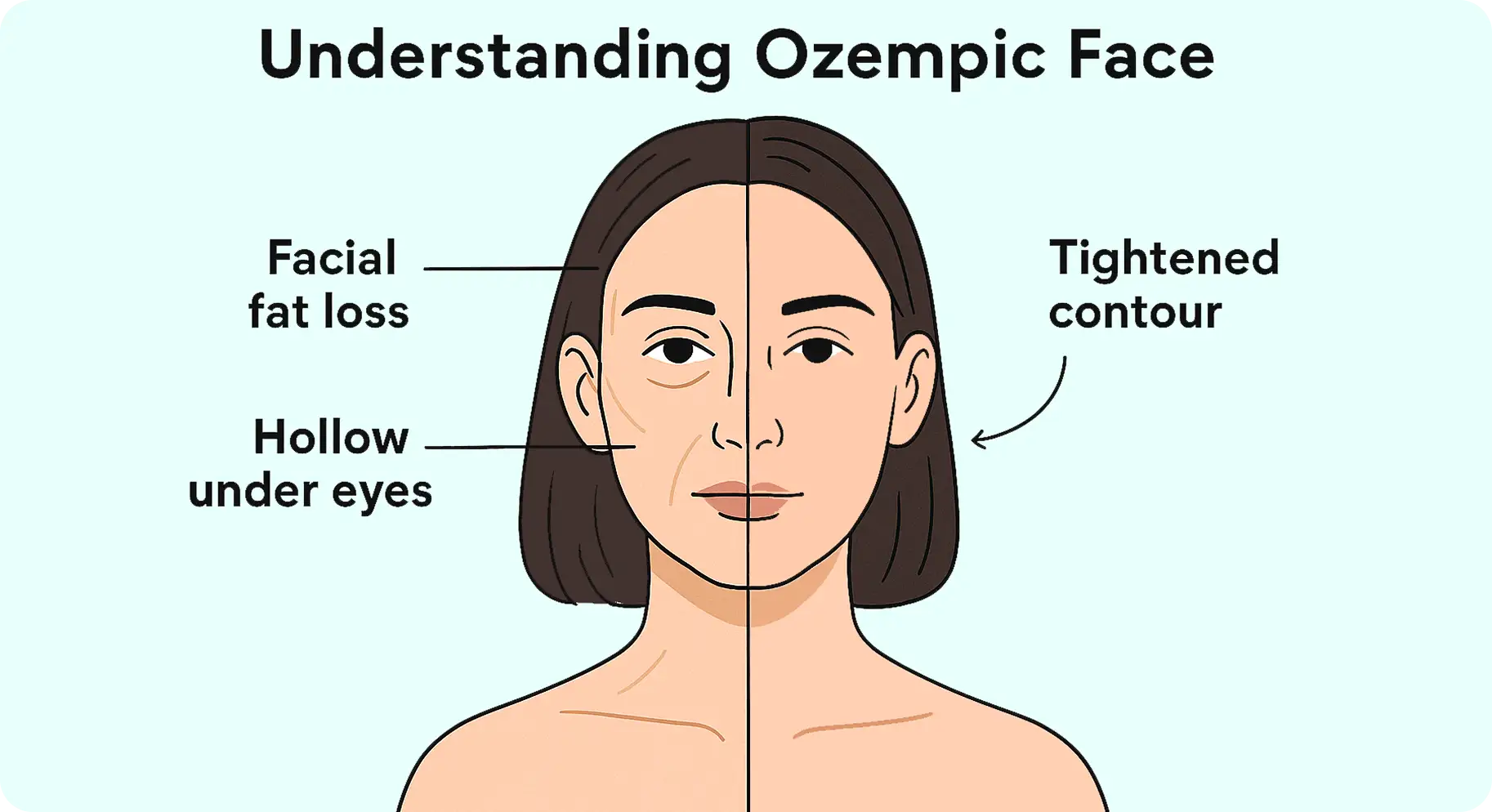 What Is “Ozempic face” and Can Aesthetic Treatments Reverse It? | Perfect B